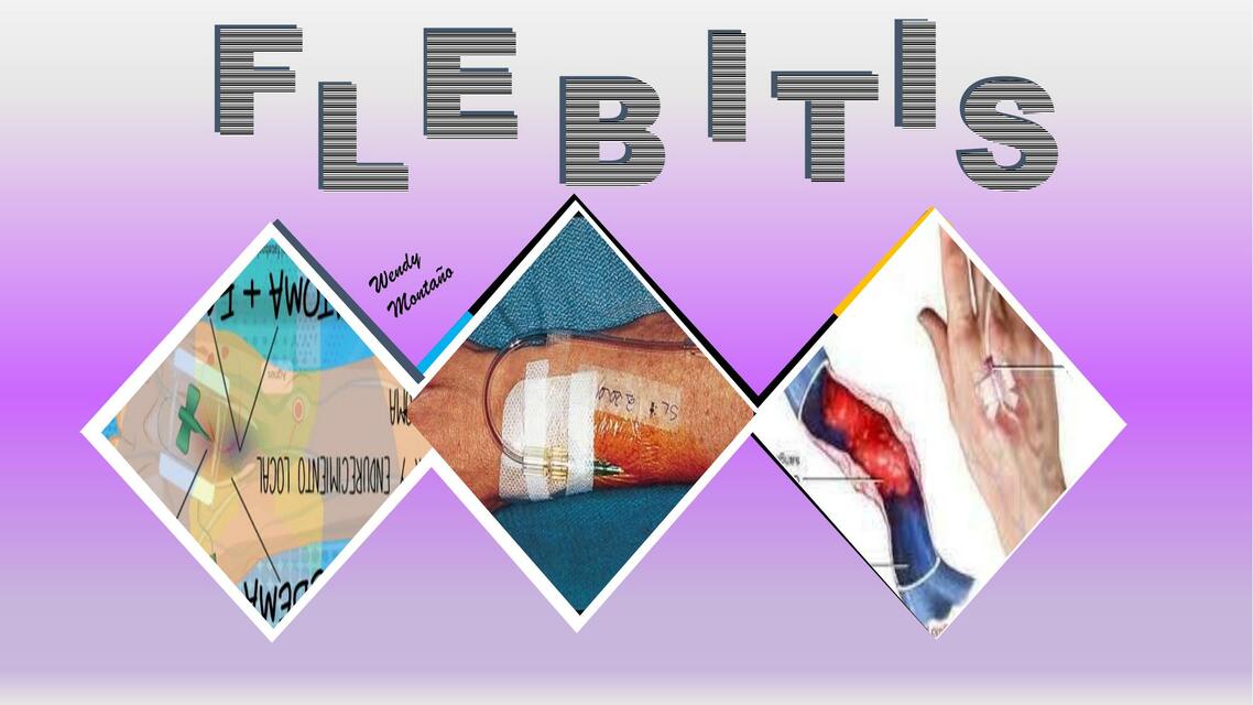 Flashcards de Flebitis | Por Wendy Montaño | uDocz