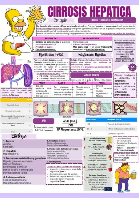 CIRROSIS HEPATICA | @medicerebros | uDocz