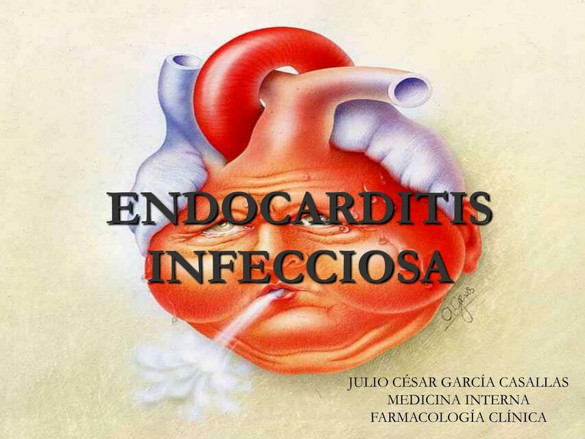 Endocarditis infecciosa | Brynner Alvarado | uDocz