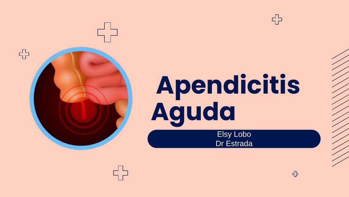 Apendicitis aguda | Alejandra Reyes | uDocz