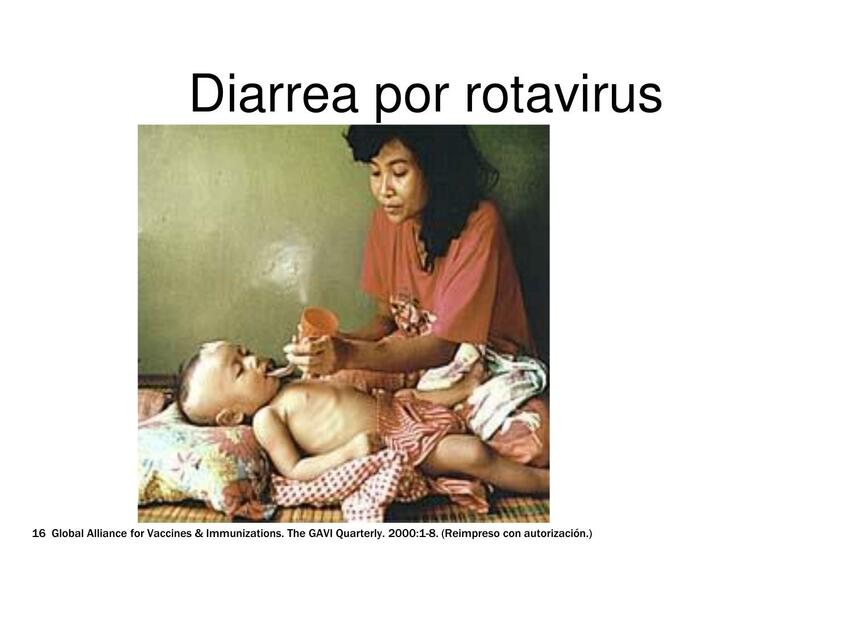 Diarrea por rotavirus | Valeria Amador | uDocz