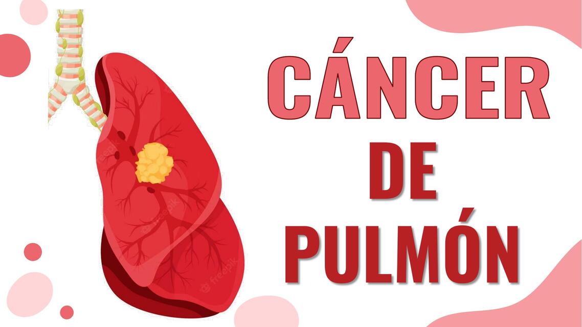 cancer de pulmon | uDocz