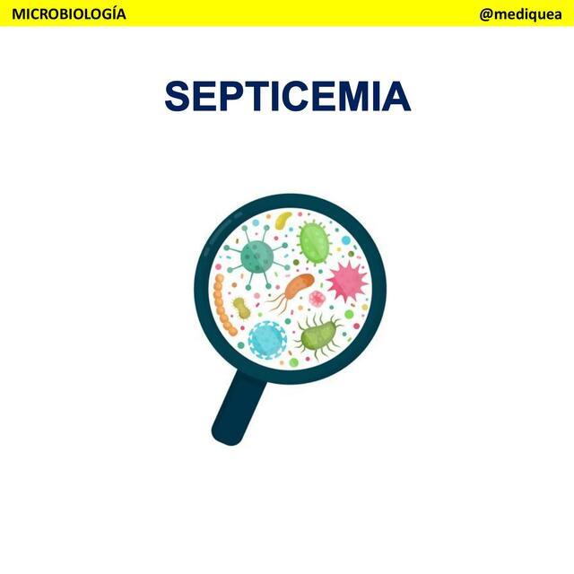 Septicemia | Ariel | uDocz