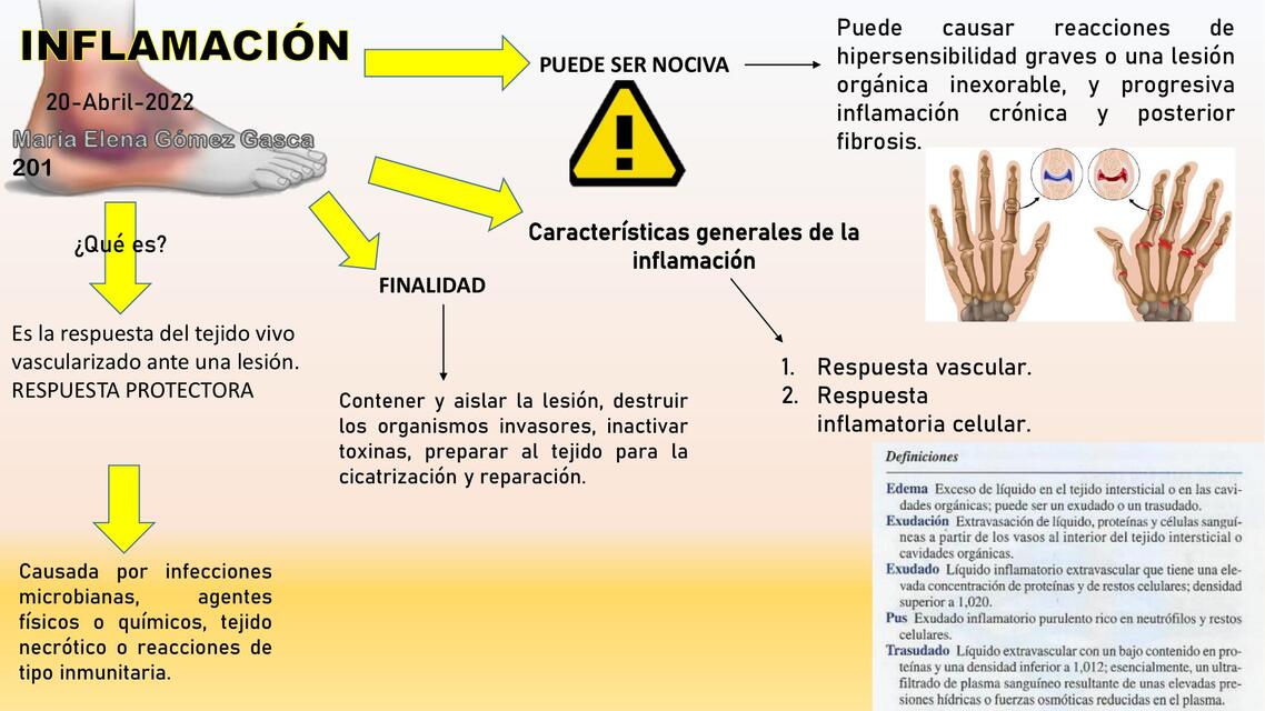 Inflamación | María Elena Gómez Gasca | uDocz