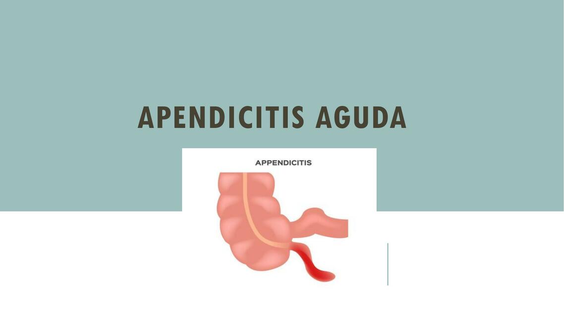 Flashcards de Apendicitis aguda | Por Dra. F | uDocz