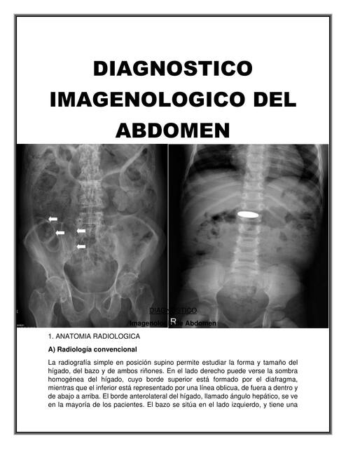 DIAGNOSTICO IMAGENOLOGICO DEL ABDOMEN | Nahir Janco | uDocz