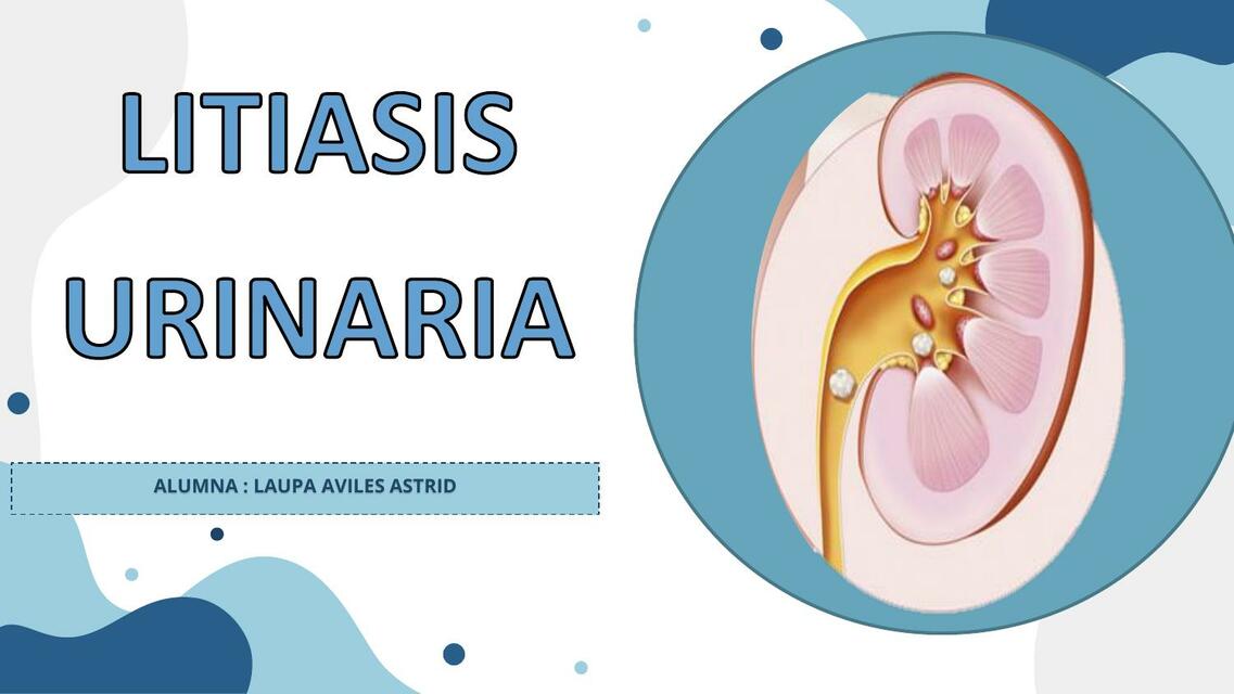 Litiasis renal | Astrid Laupa | uDocz