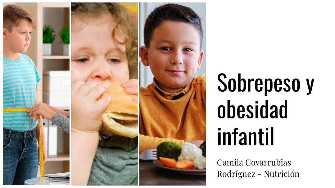 Sobrepeso y obesidad infantil | Camila Rodriguez | uDocz