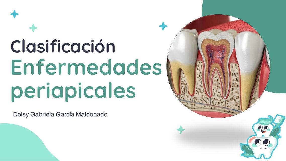 Clasificación enfermedades periapicales | Delsy Garcia | uDocz