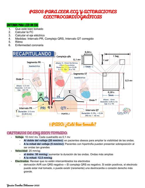 PASOS PARA LEER ECG Y ALTERACIONES ELECTROCARDIOGR | Yessica Sanchez | uDocz