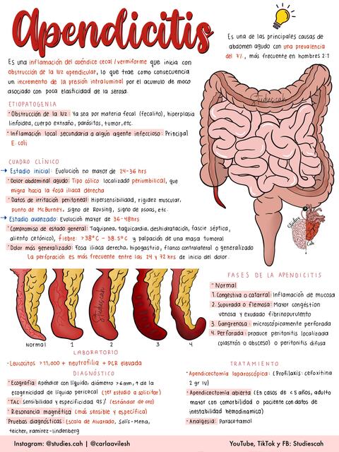 Apendicitis | Jorge Luis | uDocz
