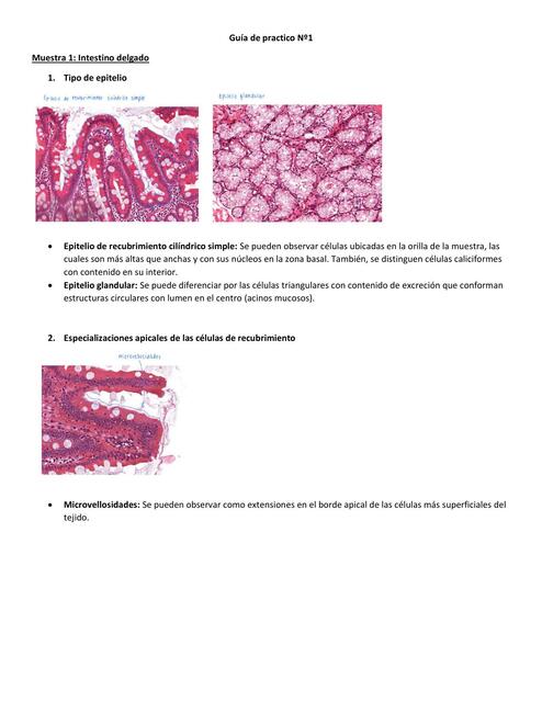 Muestras de tejido epitelial y conectivo rotulada | Matilde Rodríguez ...