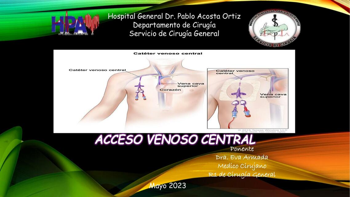 Acceso venoso central | Dariana osto Osto | uDocz