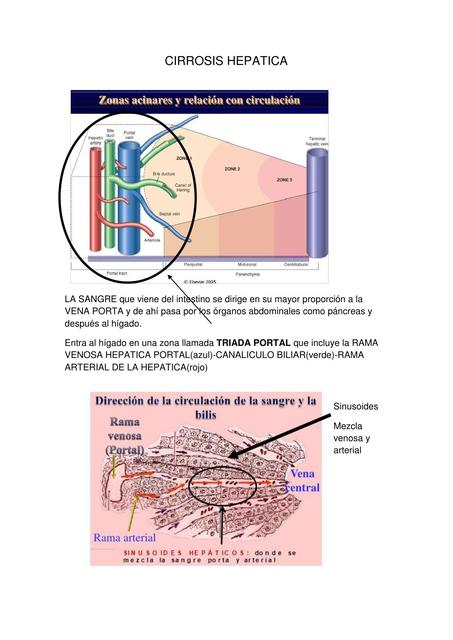 CIRROSIS HEPATICA I RESUMEN | GERARDO NARVAEZ | uDocz