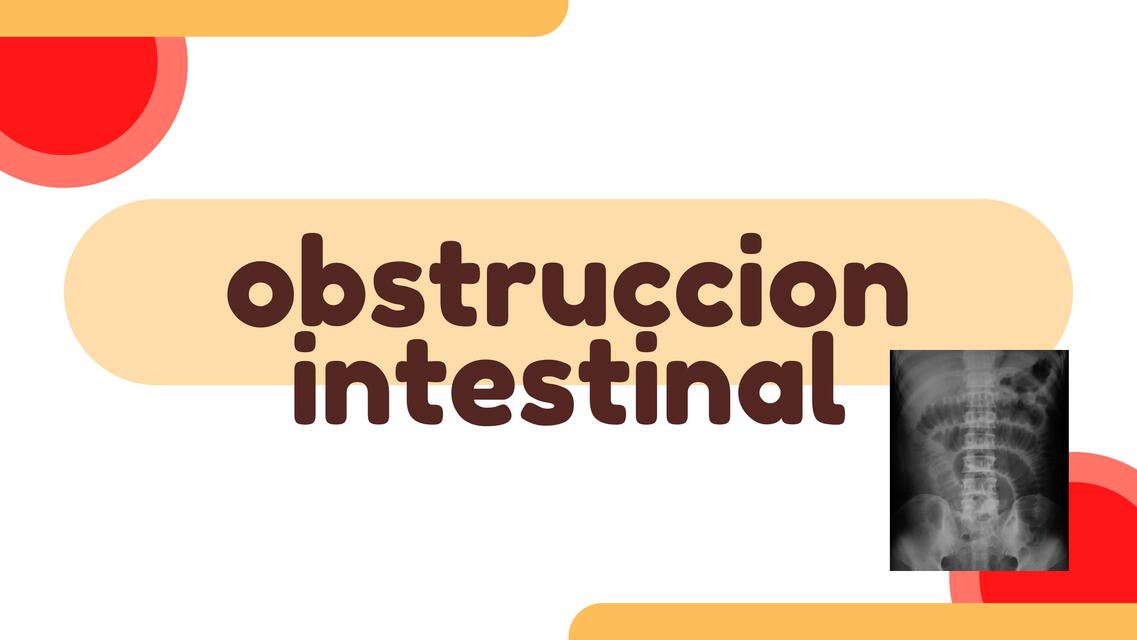 Obstrucción Intestinal | Pili | uDocz