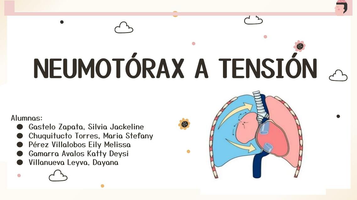 Causas Del Neumotórax A Tensión