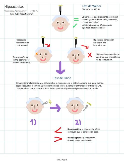 Hipoacusias Amy Rojas | Amy Rojas | uDocz
