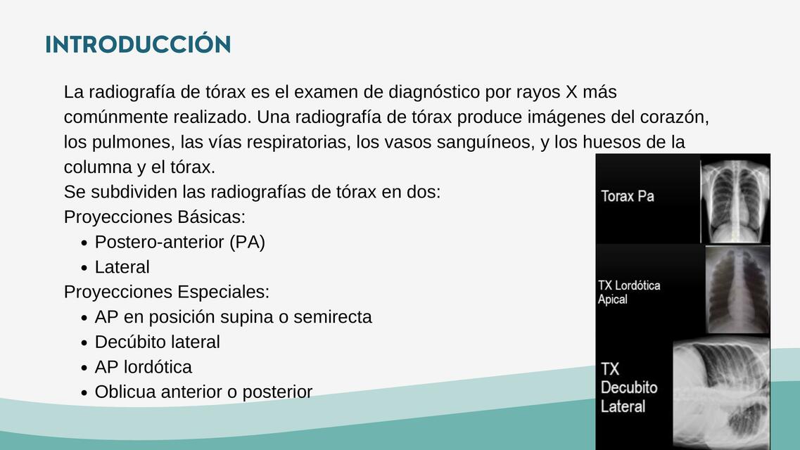 Proyecciones radiológicas | med learn21 | uDocz