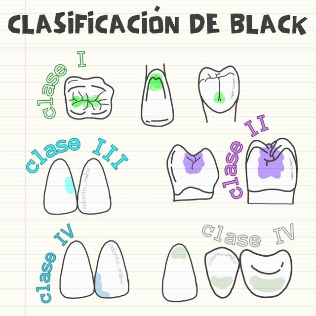 Clasificación de Black | Milena Bustos | uDocz