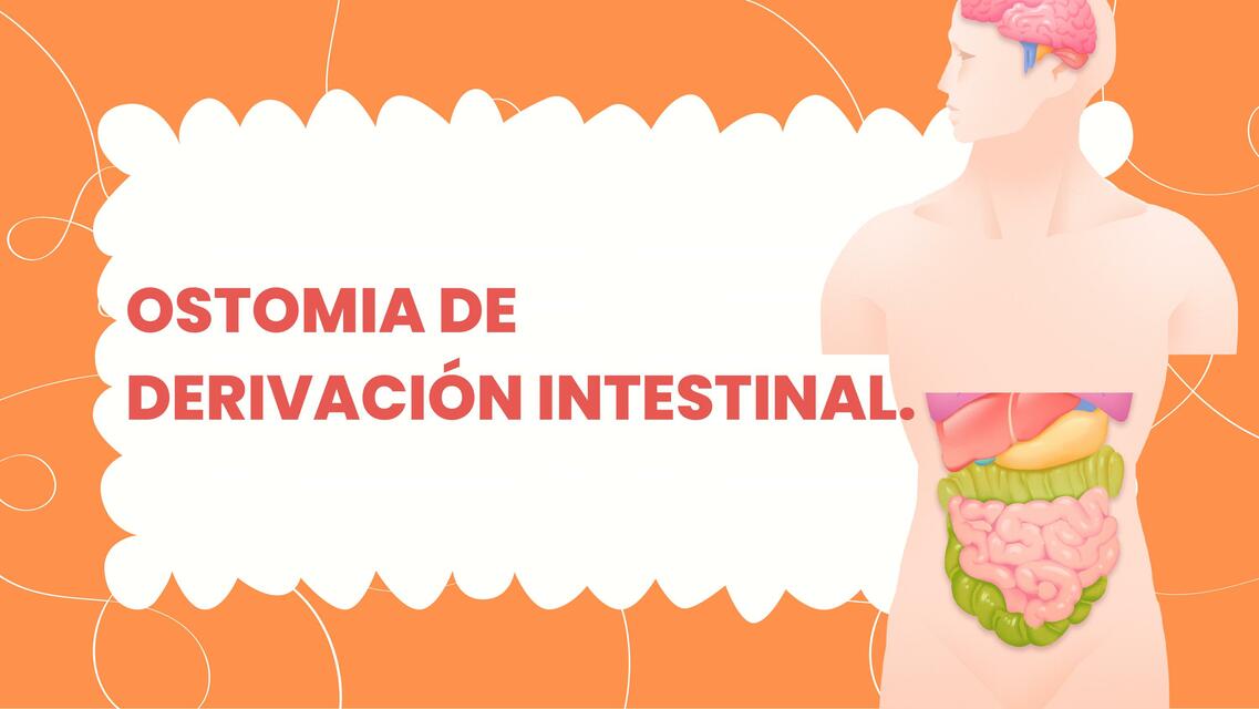 Ostomía de derivación intestinal | Amanda Carolina Solis Gallegos | uDocz