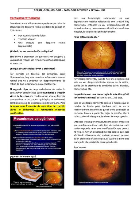 PATOLOGIA DE VITREO Y RETINA 2da parte | MED STUDENT | uDocz