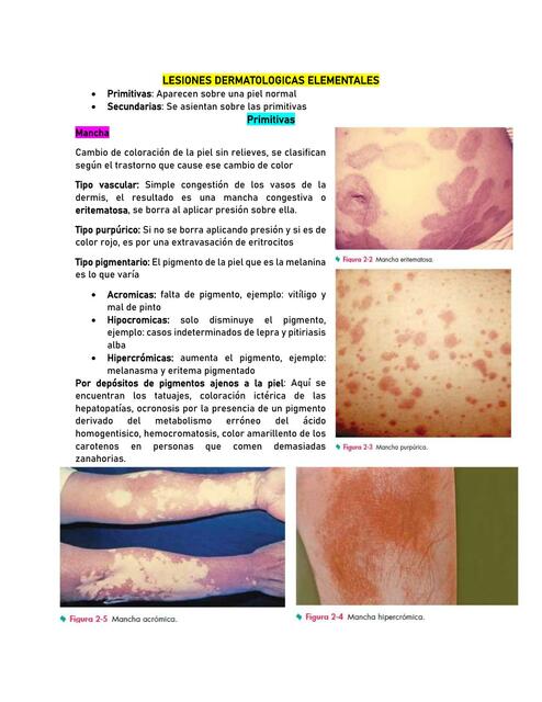LESIONES DERMATOLOGICAS ELEMENTALES | Luis Alfonso Flores Domínguez | uDocz
