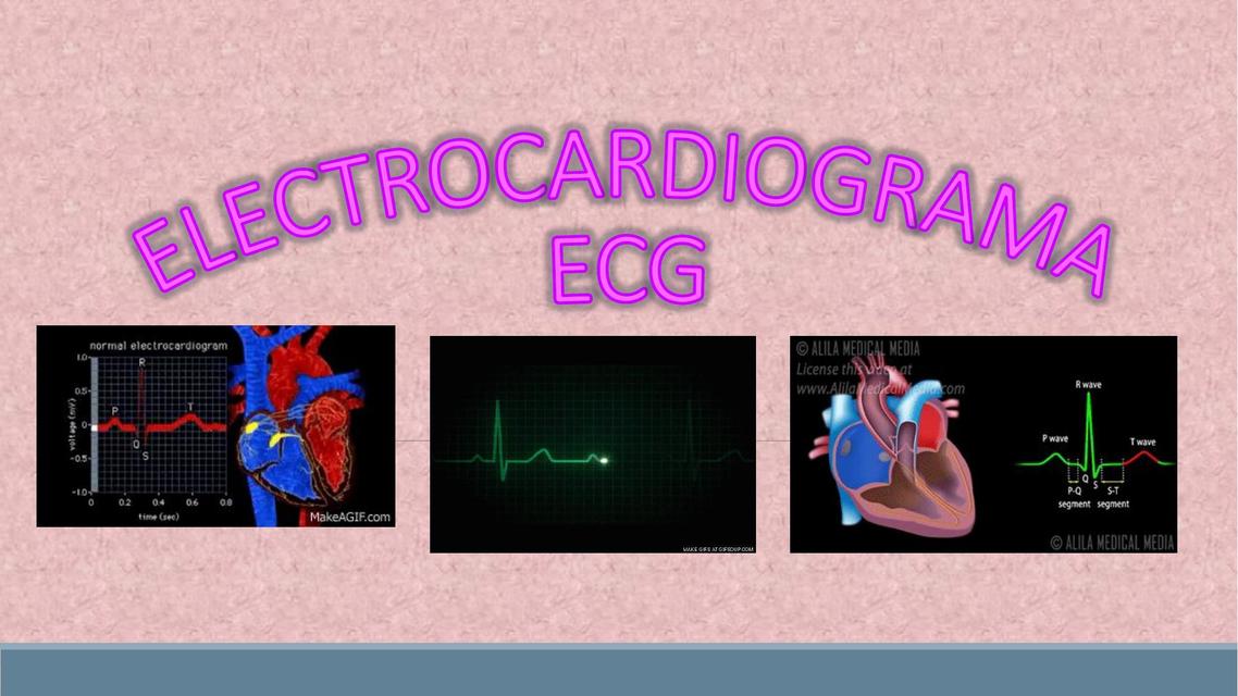 ELECTROCARDIOGRAMA ECG