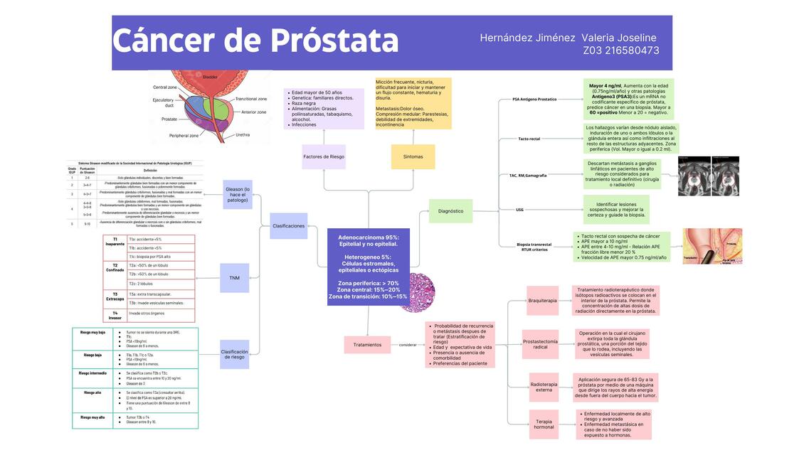 Cáncer de Próstata | Valeria Hernández | uDocz