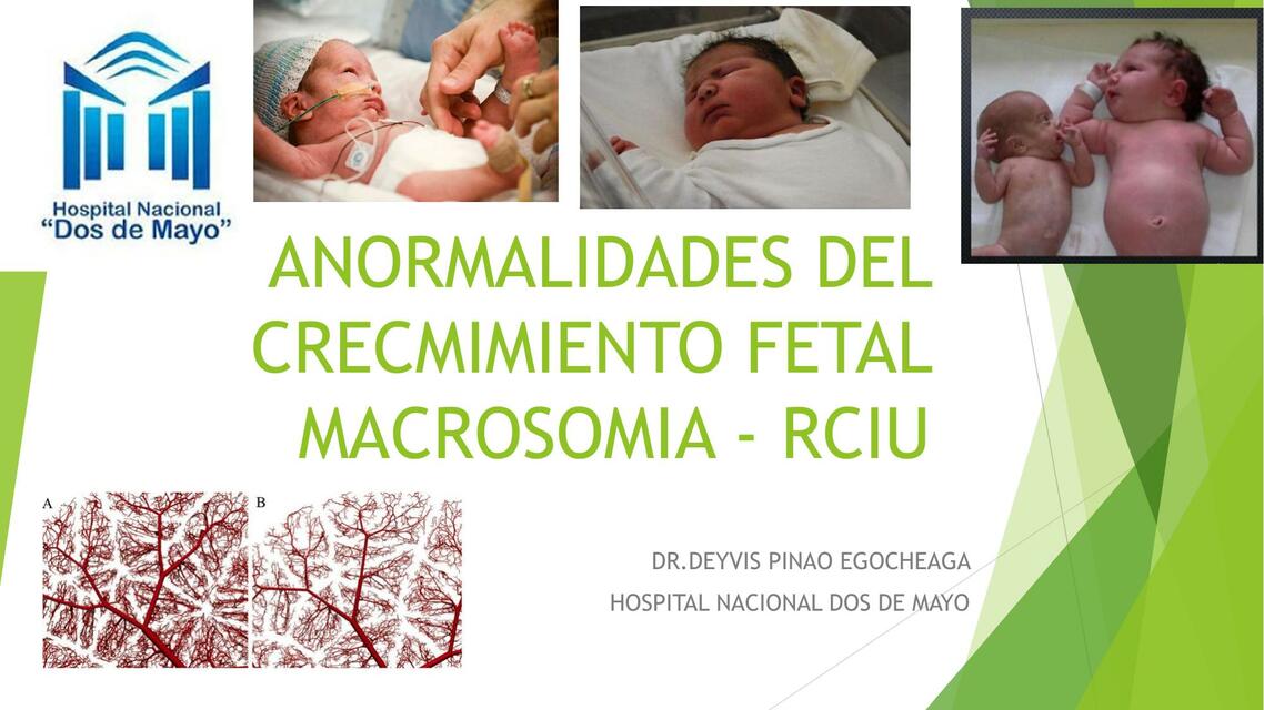 Flashcards de 8 ANORMALIDADES DEL CRECMIMIENTO FETAL | Por Dra. Lulú ...