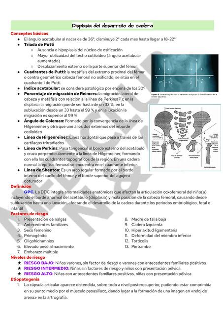 Displasia del Desarrollo de Cadera | Nadia Millan | uDocz