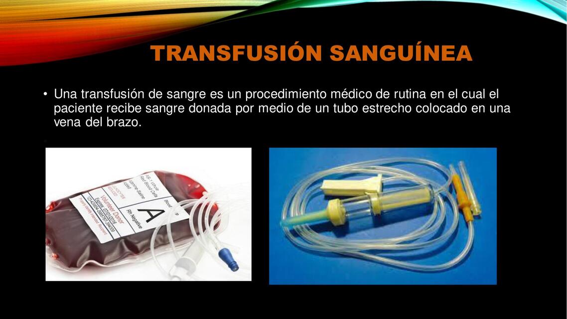 Transfusión sanguínea | Lizeth lima Guillén | uDocz