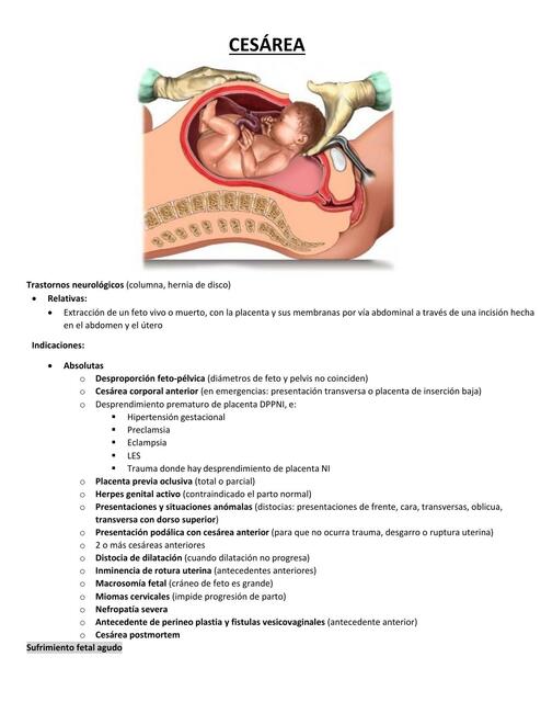 Cesárea | Enfermería | uDocz