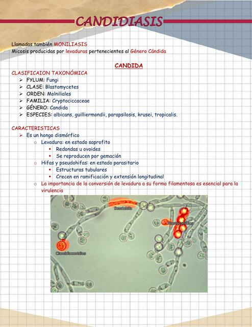 Candidiasis | Alain Alvarez | uDocz