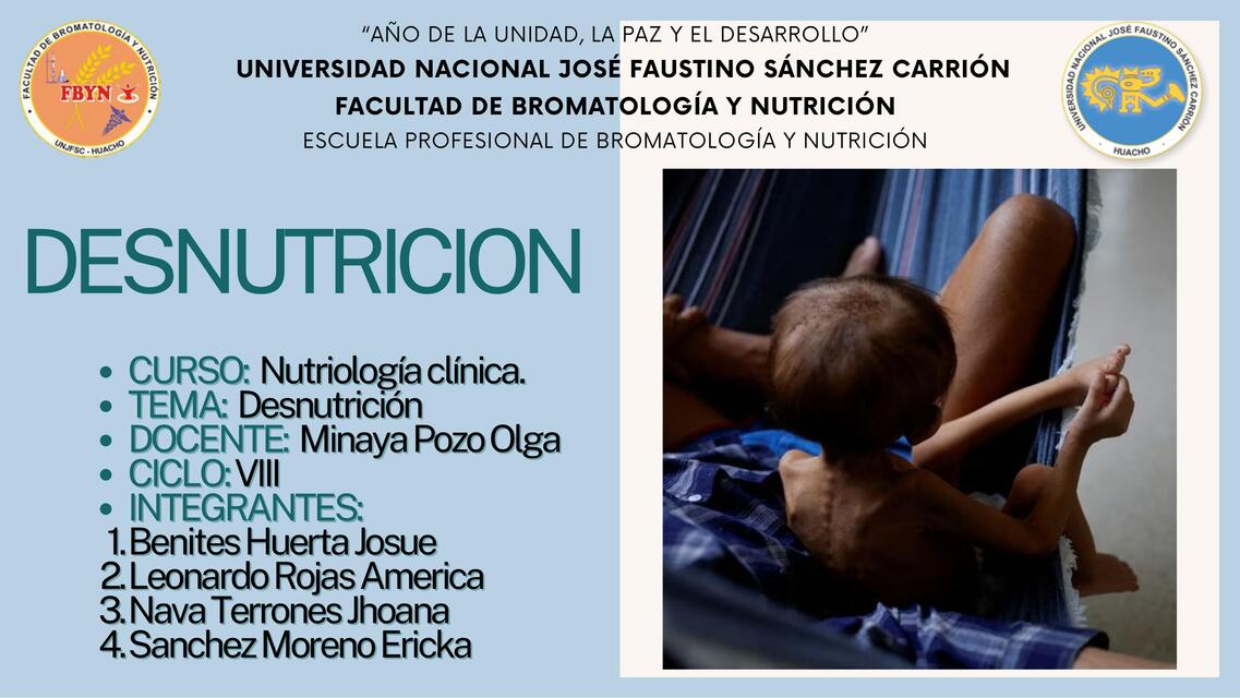 Desnutrición Sanchez Moreno Ericka Milagros Udocz