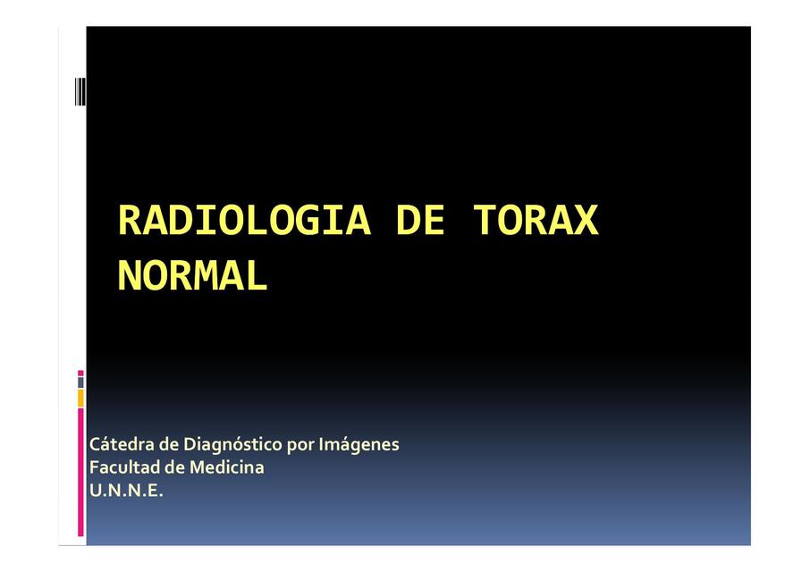 Radiologia de torax normal | Noel Sánchez | uDocz