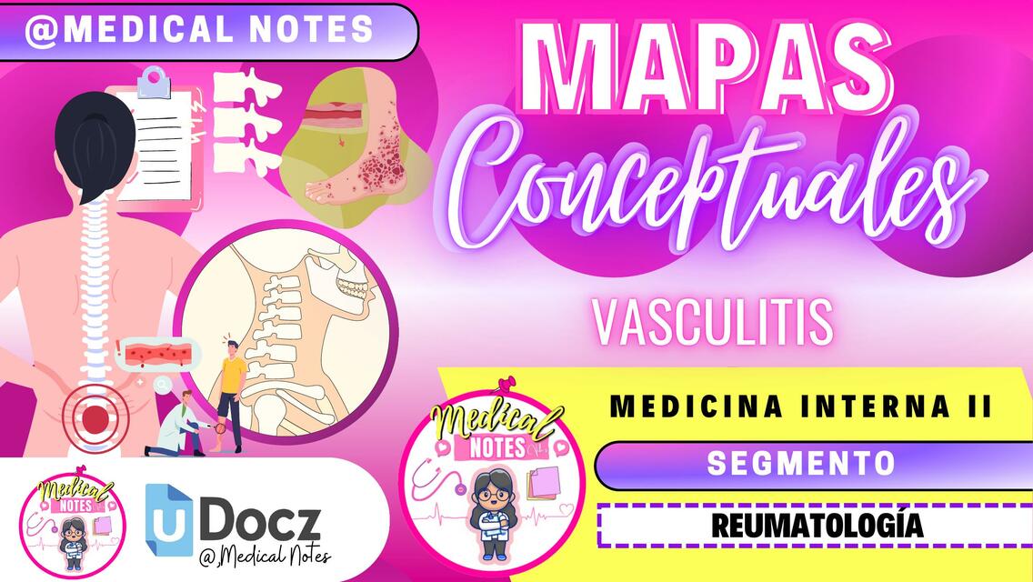 Vasculitis | MEDICAL NOTES | uDocz