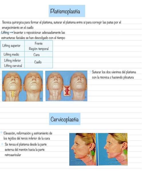Platismoplastía | laurav98o | uDocz