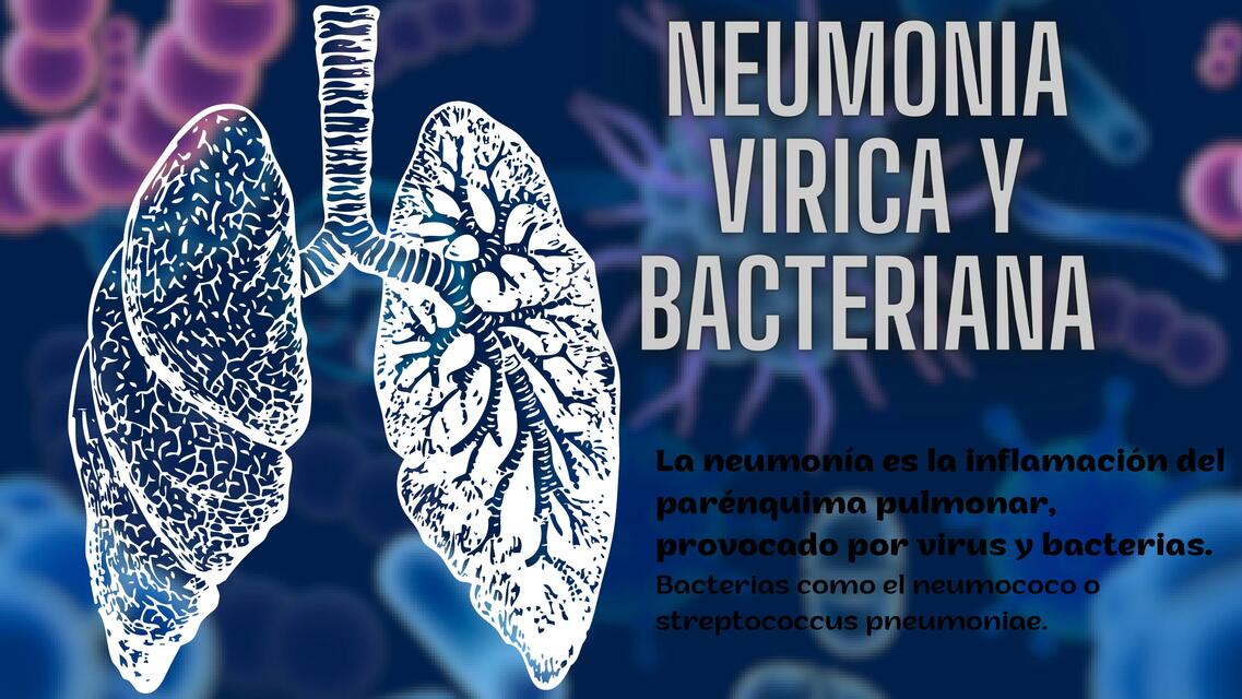 NEUMONIA VIRICA Y BACTERIANA | Celeste Quiroz | uDocz