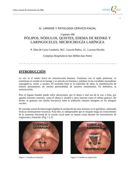 Flashcards de Pólipos, nódulos, quistes, edema de reinke y laringoceles ...