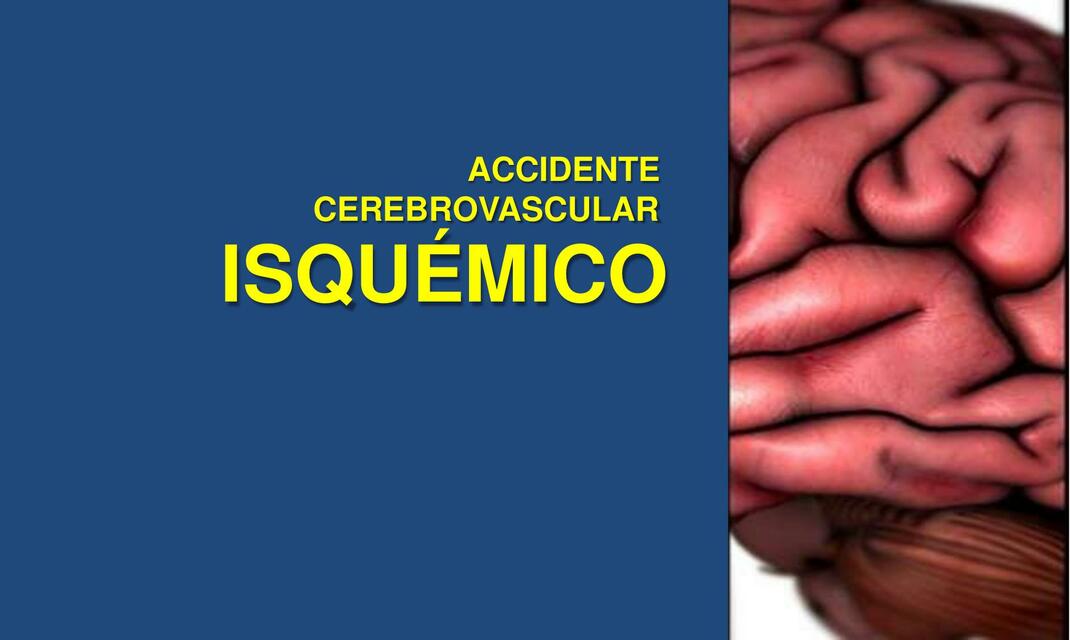 Accidente cerebrovascular isquémico | DIGITAL MEDICINA | uDocz