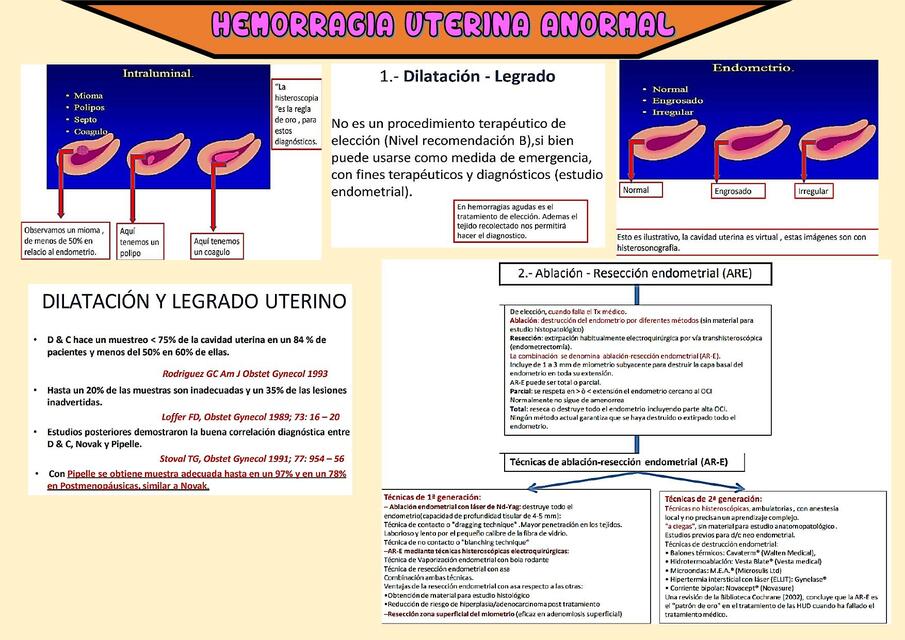 Hemorragia Uterina Anormal dilatación y legrado uterino | Mishelle Chavez | uDocz
