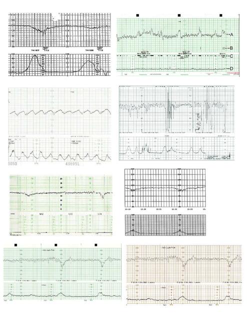 TOCOCARDIOGRAMA | Fernando | uDocz
