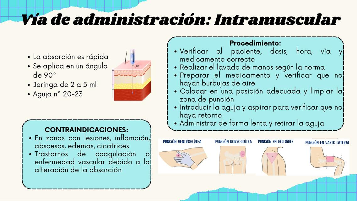 Vía Intramuscular Nursing Assist4nce Udocz