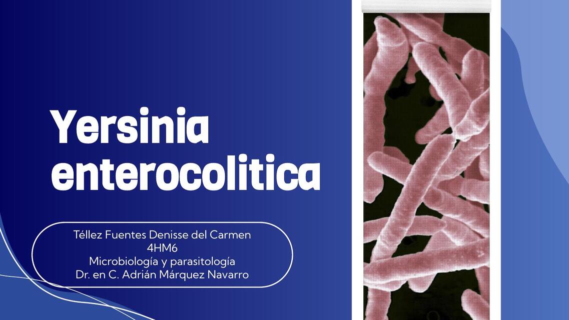 Yersinia Enterocolitica Yersiniosis Yersinia Cdc