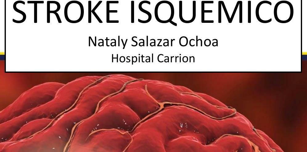 Stroke Isquémico | Michi ;) | uDocz