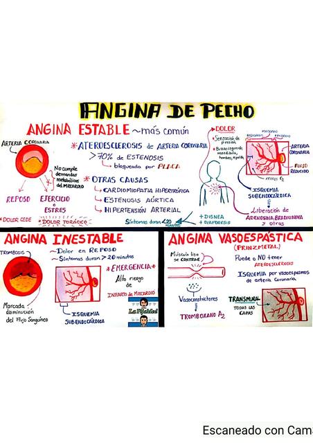 TIPOS DE ANGINA DE PECHO | lafijamed | uDocz TIPOS DE ANGINA DE PECHO | lafijamed | uDocz