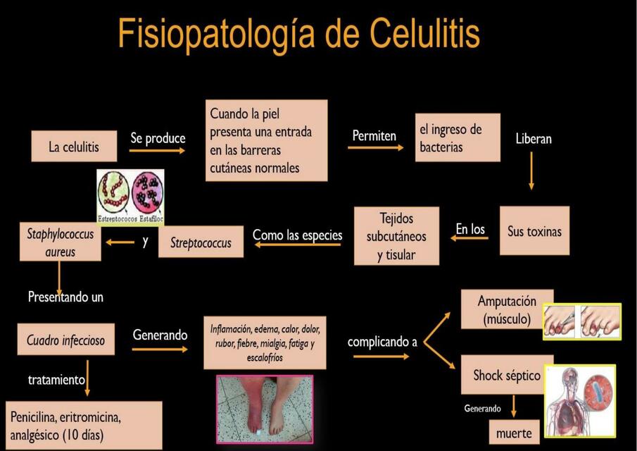Que Es La Celulitis Infecciosa Tratamiento Medico