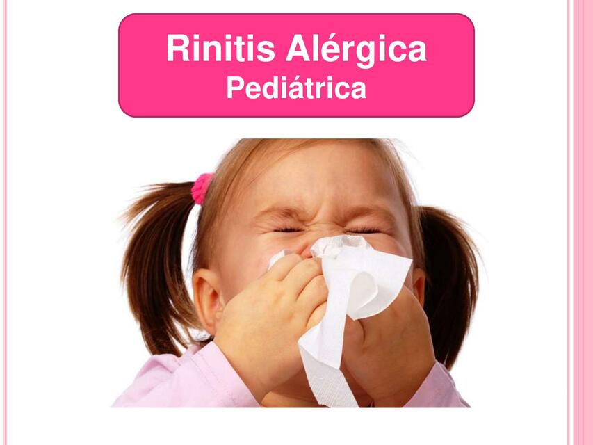 RINITIS ALERGICA PEDIATRICA | uDocz