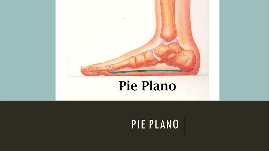 Pie plano | uDocz