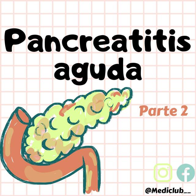 Pancreatitis aguda | MEDICLUB | uDocz
